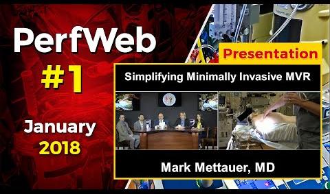 Simplifying Minimally Invasive MVR - Minimally Invasive Mitral Valve ...